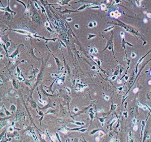 The Primary Cells Market (Part 1): Sources of Primary Cells for ...